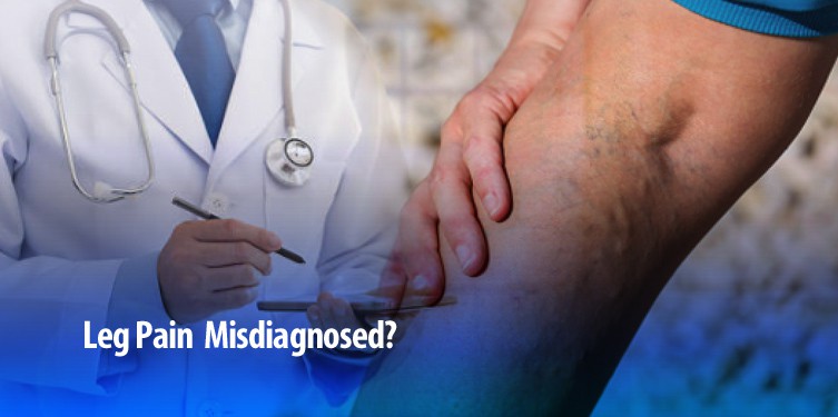 Leg Pain - Misdiagnosed Leg Pain - Maryland Vascular Specialists